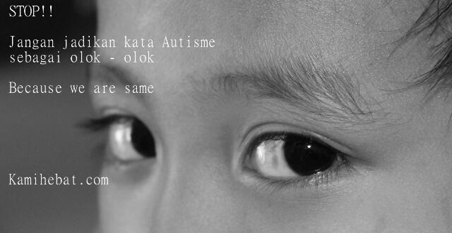 Tokoh Dunia Yang Diprediksi Autisme | KASKUS