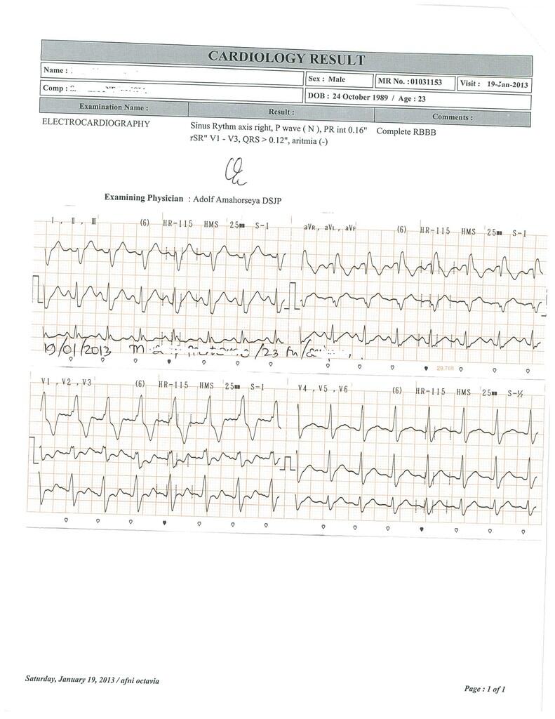 [Ahli Jantung Please Masuk! ] Medical Check Up for Pre Employment (ECG ...
