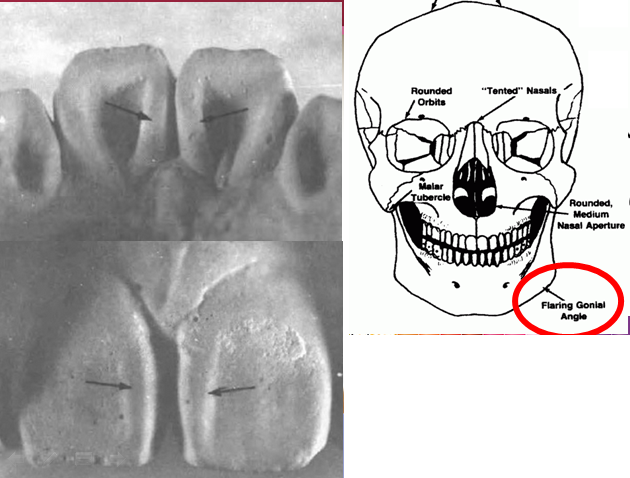 Dari Manakah Asal Nenek Moyang Orang Indonesia Sebenarnya?? - Page 6 ...