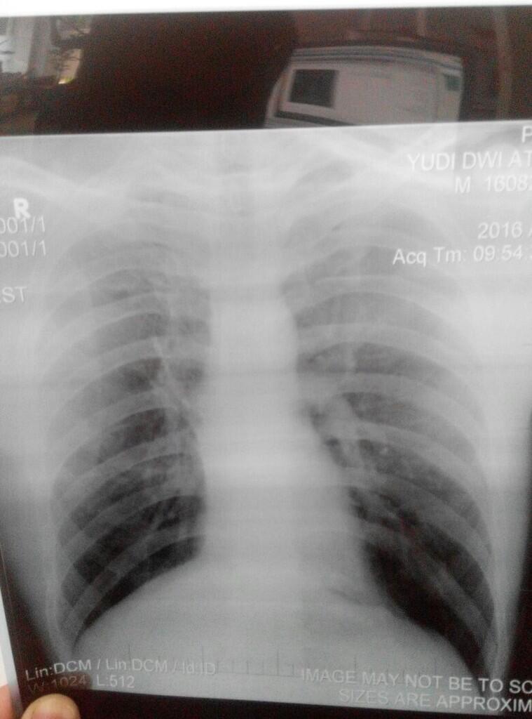 Tolong baca Hasil Rontgen | KASKUS