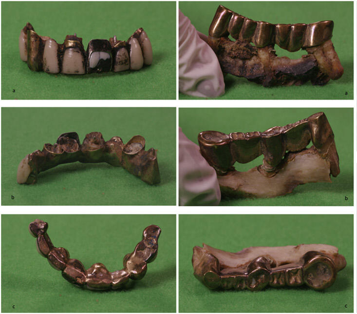 Gigi Hitler Ungkap Penyebab Kematian Sang Diktator Nazi | KASKUS