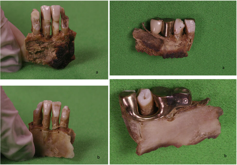 Gigi Hitler Ungkap Penyebab Kematian Sang Diktator Nazi | KASKUS