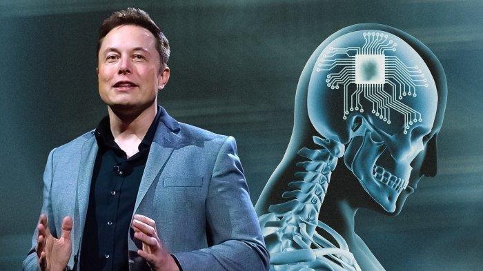 Neuralink Milik Elon Musk Menerima Persetujuan FDA untuk Chip Otak | KASKUS
