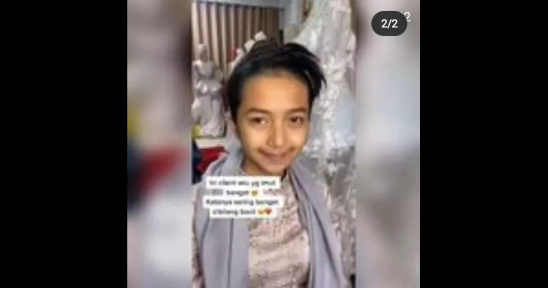 Sering Dibilang Wajah Anak Kecil, Wanita Ini Jadi Dewasa setelah ...